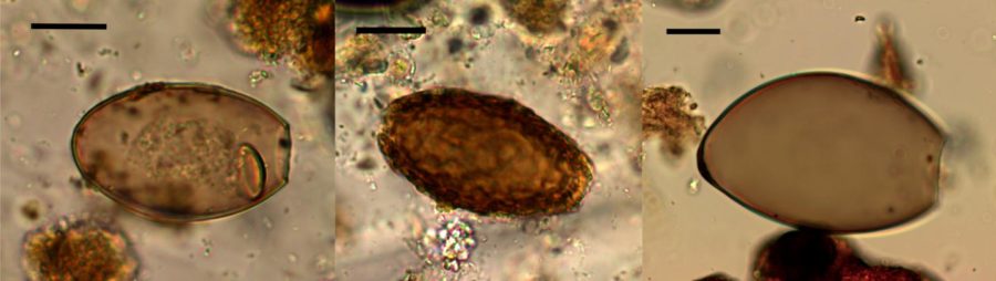 Ancient feces reveal how ‘marsh diet’ left Bronze Age Fen folk infected ...